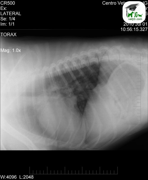 Defecto de septo interventricular DSV | Actualidad médico-quirúrgica ...