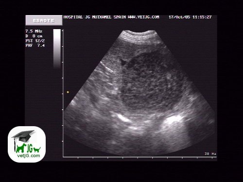 Tumor bazo | Actualidad médico-quirúrgica del Hospital JG