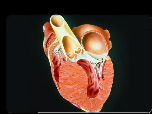 Cardiomegalia: ¿ Hipertrofia o dilatación ? | Actualidad médico ...